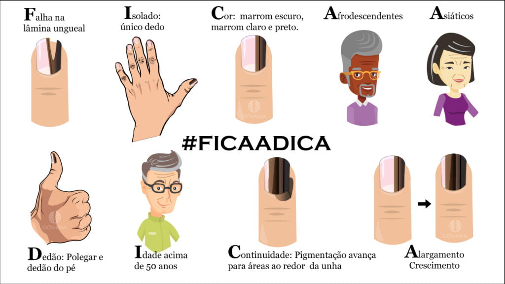 Mancha escura na unha - Quais os sinais de alerta