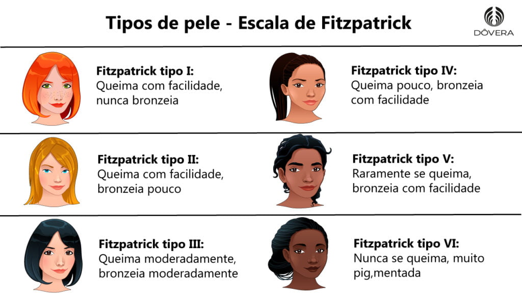 Me queimei no sol, e agora?